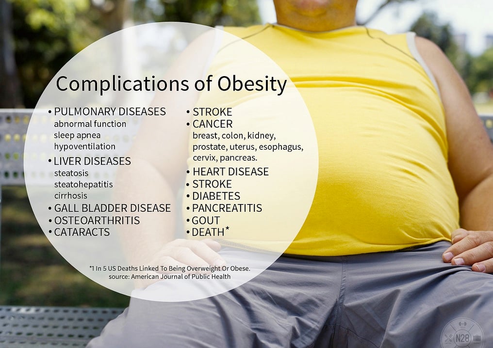 American Samoa prepares for war against obesity - Asia & Pacific