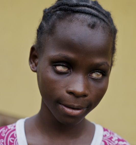 The challenge of non-communicable diseases in Africa - Sub-Saharan Africa